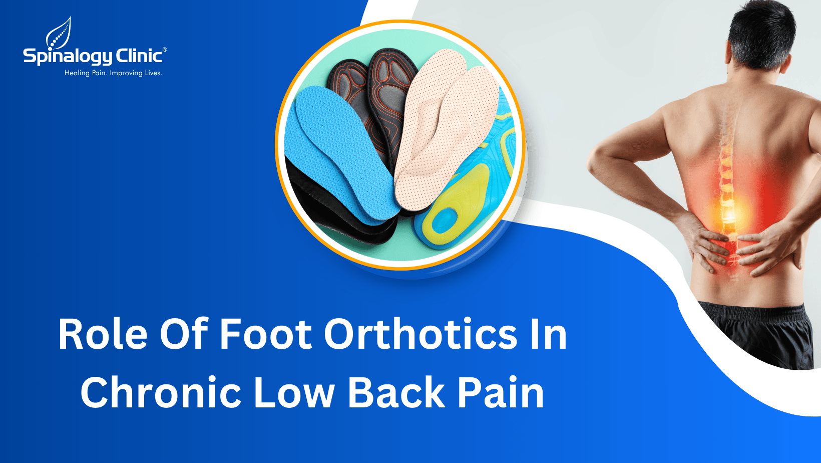 Role Of Foot Orthotics In Chronic Low Back Pain | Best Back Pain, Slip ...