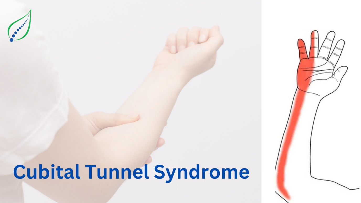 Cubital Tunnel Syndrome: Symptoms, Causes & Treatments | Best Back Pain ...