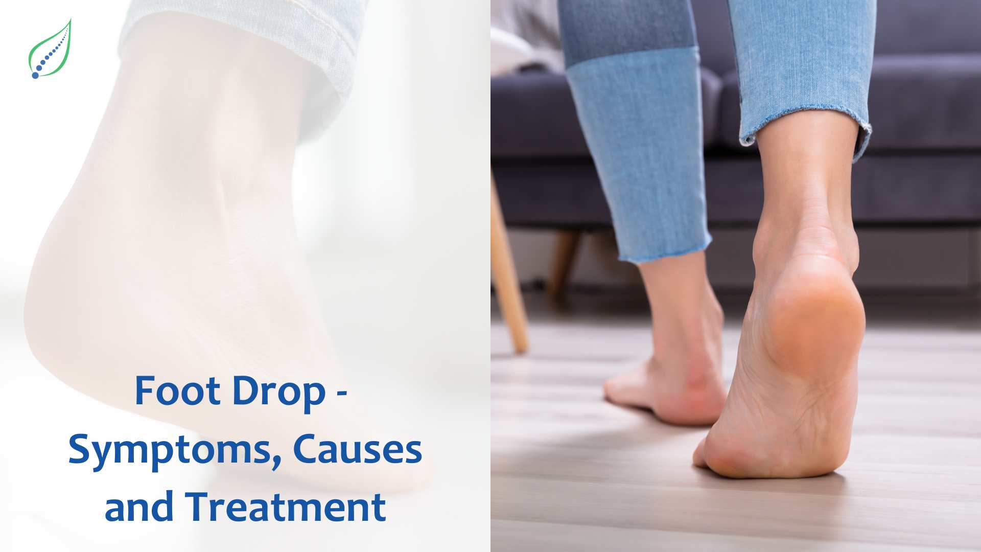 Understanding Foot Drop: Symptoms, Causes, and Effective Treatments ...