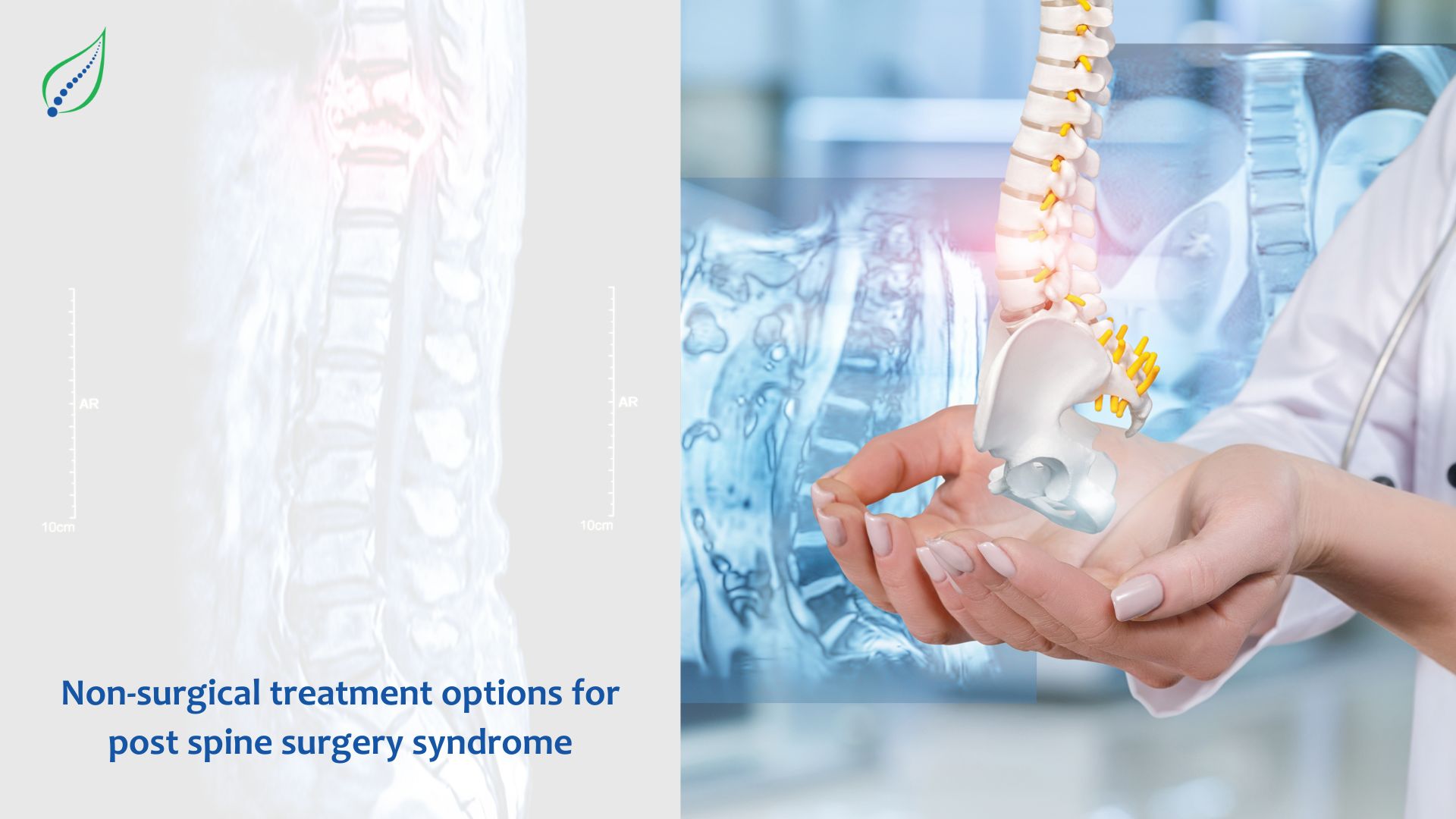 Non-Surgical Treatments for Post Spine Surgery Pain | Best Back Pain ...