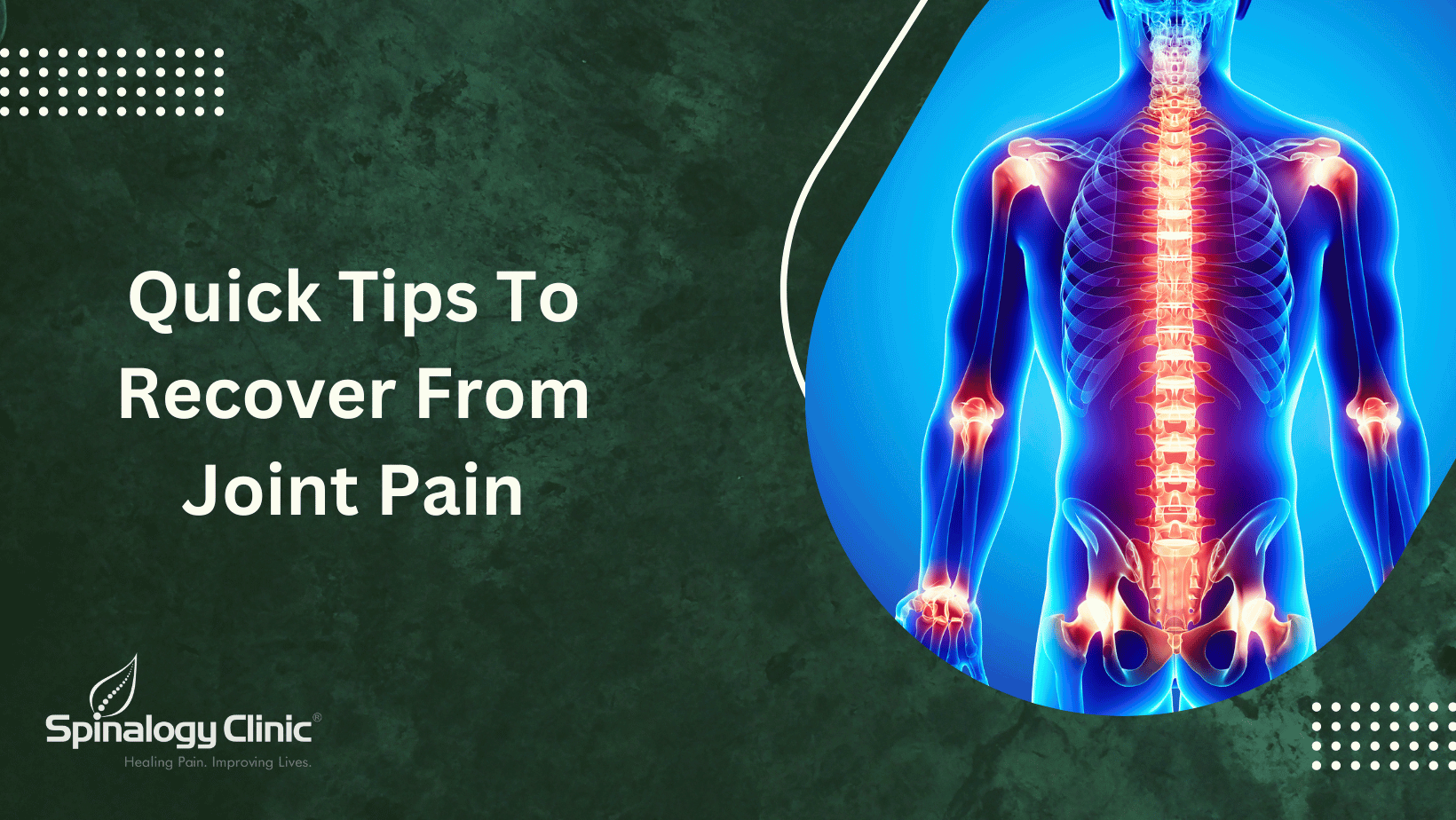 Joint Pain Relief: 7 Quick Tips for Fast Recovery | Best Back Pain ...
