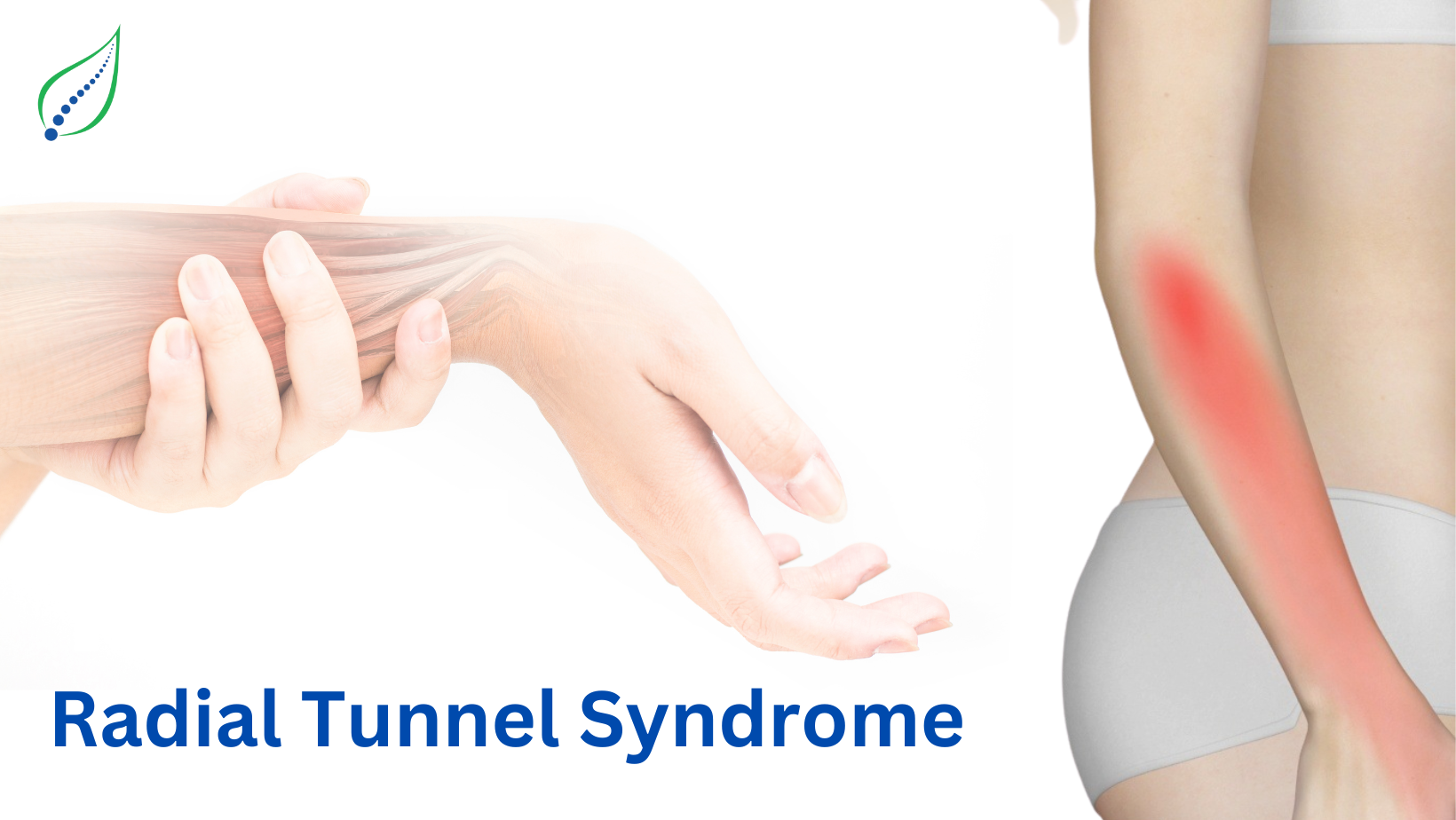 Radial Tunnel Syndrome: Symptoms, Causes, and Treatments | Best Back ...