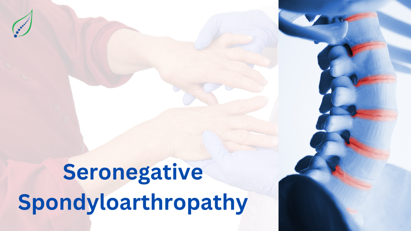 Seronegative Spondyloarthropathy: Symptoms, Causes, and Treatment ...