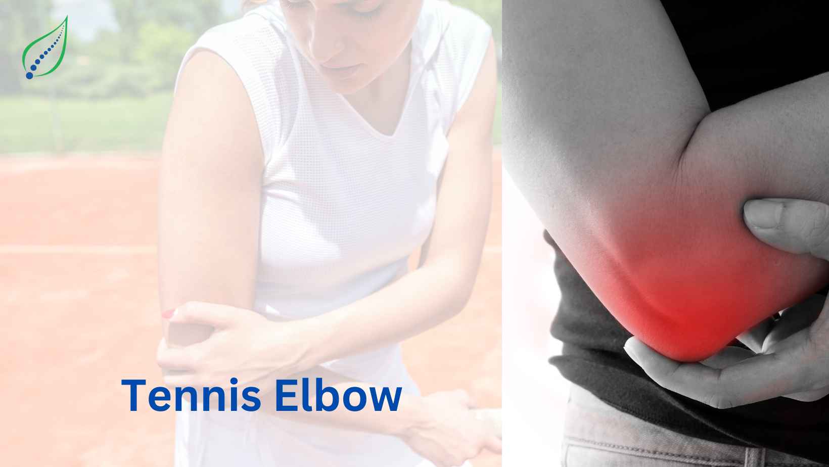 Best Treatment in Pune for Tennis Elbow | Spinalogy Clinic | Best Back ...