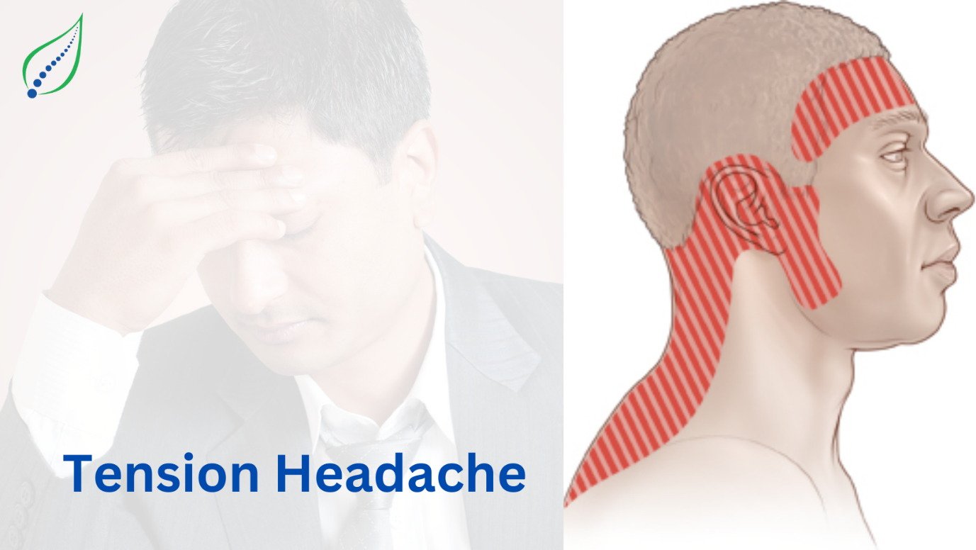 What is Tension Headache | Best Back Pain, Slip Disc, Knee Arthritis ...