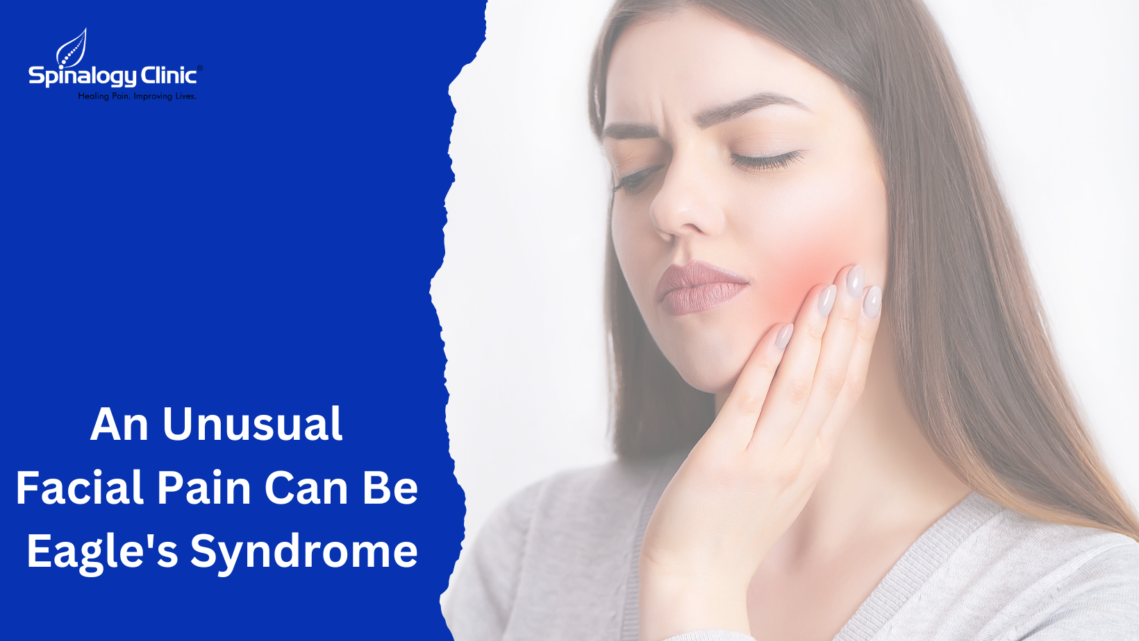 Eagles Syndrome | Best Back Pain, Slip Disc, Knee Arthritis, Sciatica ...