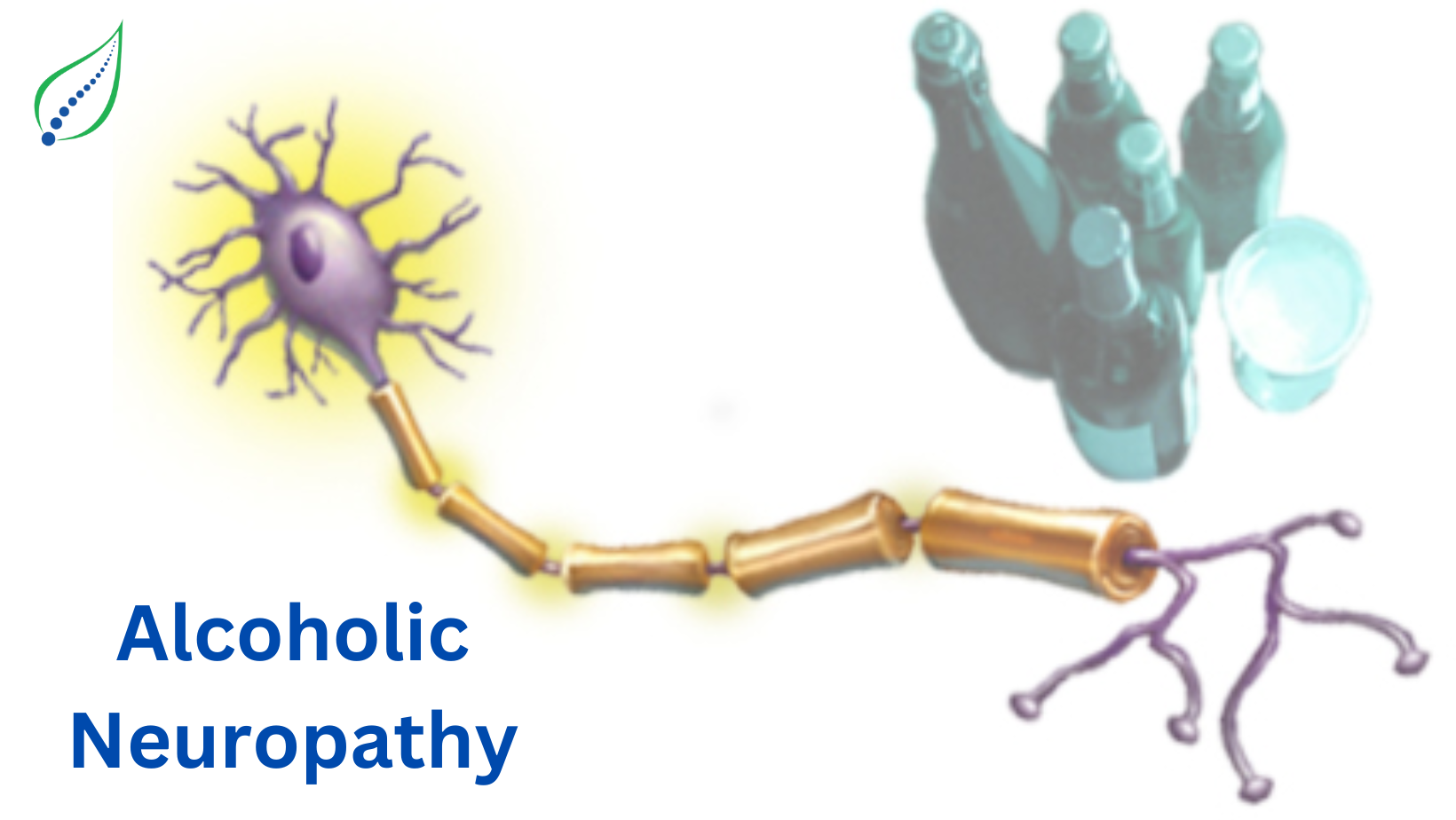 Alcoholic Neuropathy: Symptoms, Causes, & Treatment | Best Back Pain ...